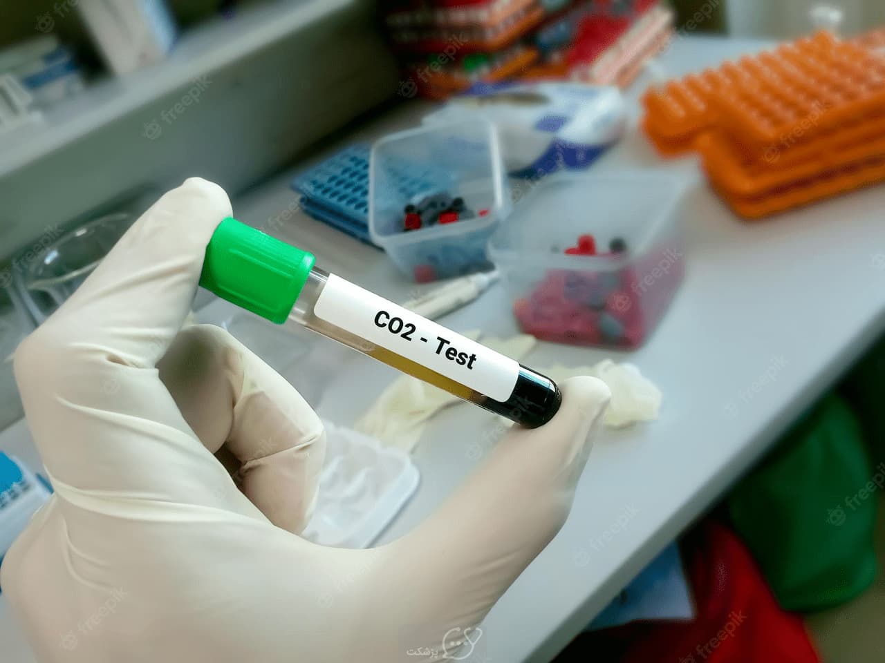 تست CO2 در خون || پزشکت